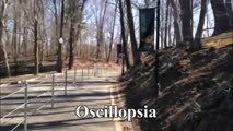 Oscillopsia: A Common Symptom of Bilateral Vestibular Loss | Eccles ...