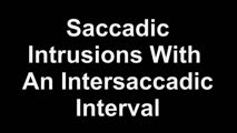 Saccadic Intrusions with an Intersaccadic Interval | Eccles Health ...