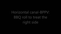 Horizontal Canal - BPPV: BBQ Roll to Treat the Right Side | Eccles ...