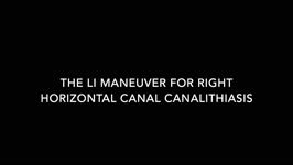 Li Maneuver for Geotropic Right HC-BPPV, Canalithiasis (Video) | Eccles ...